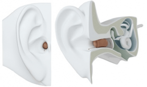 Learn How Hearing Works | Medical Audiology Services